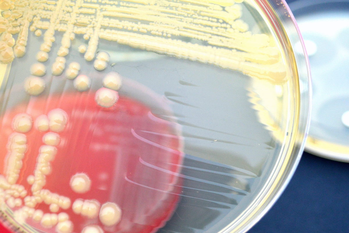 Unlocking the Microbial World: Exploring Essential Microbiology ...