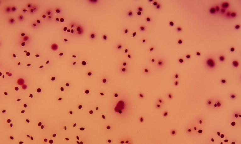 Culture media for the detection of Enterobacteriaceae | Laboratory Talk