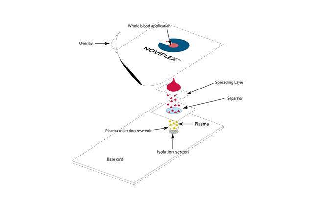 Blood plasma collection cards | Laboratory Talk